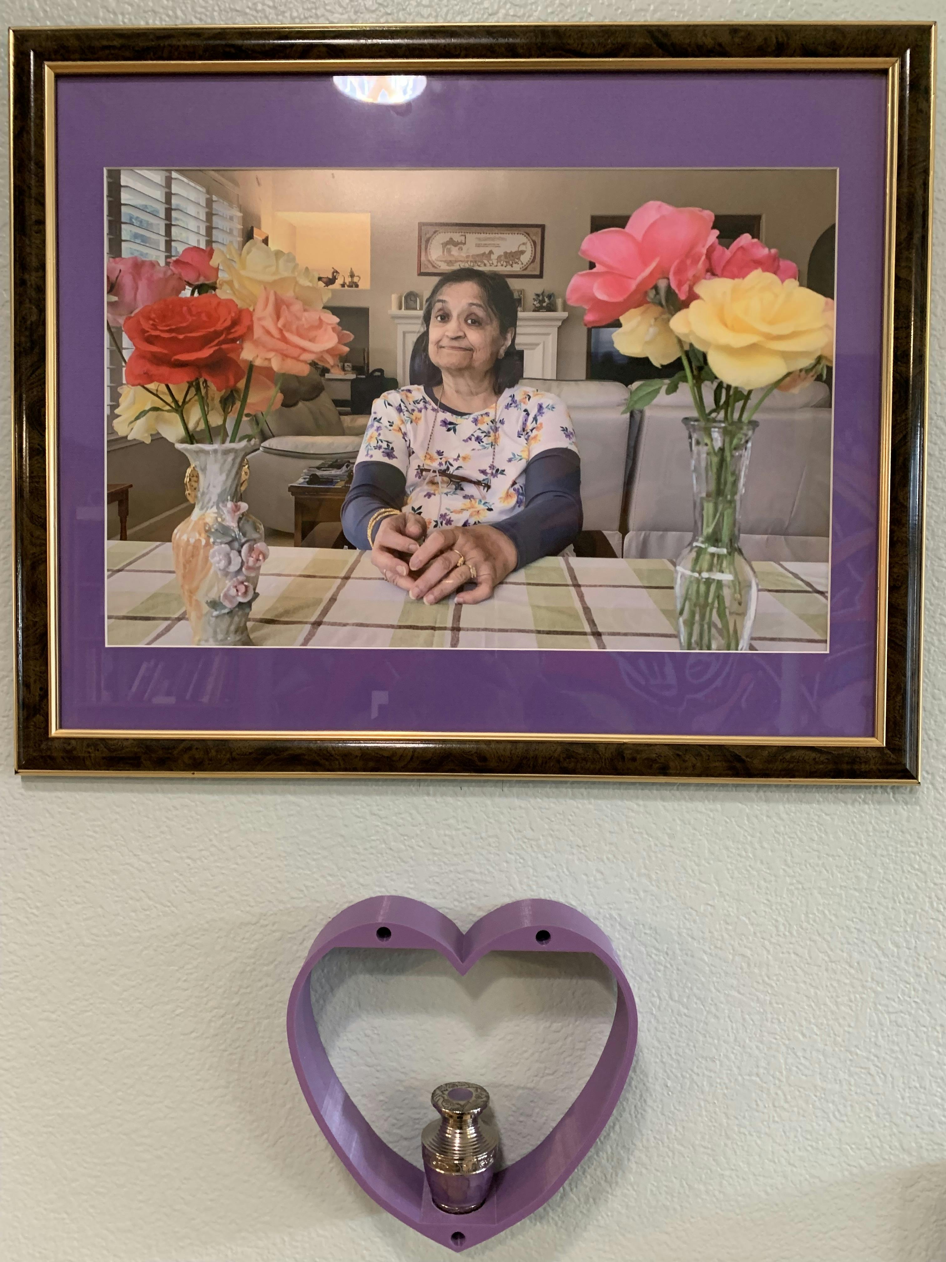 Chordoma Foundation | Ameeta Shah's Uncommon Story